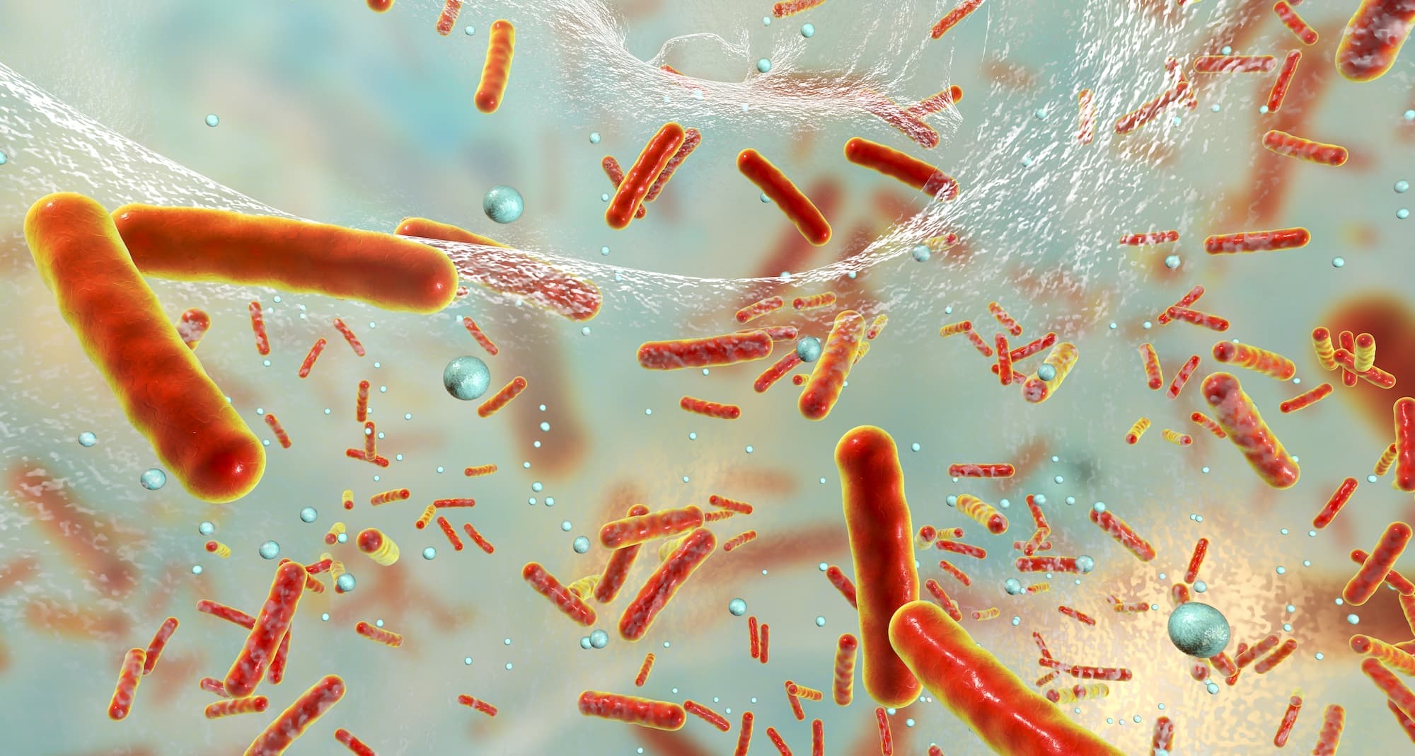 Bacterial Infection Care in Irvine - Center for New Medicine